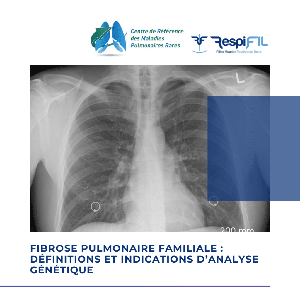 Fibrose pulmonaire familiale : définitions et indications d’analyse ...