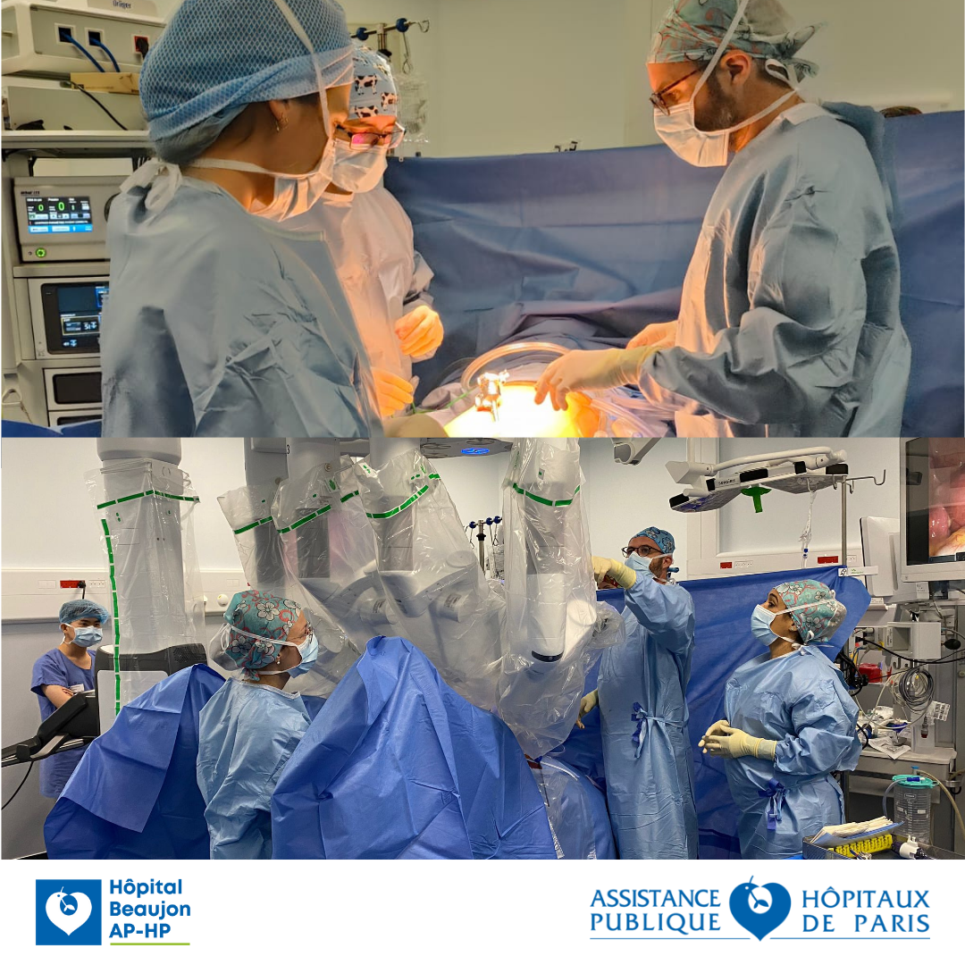 Les chirurgies robot assistées à l’hôpital Beaujon | Hôpital Beaujon